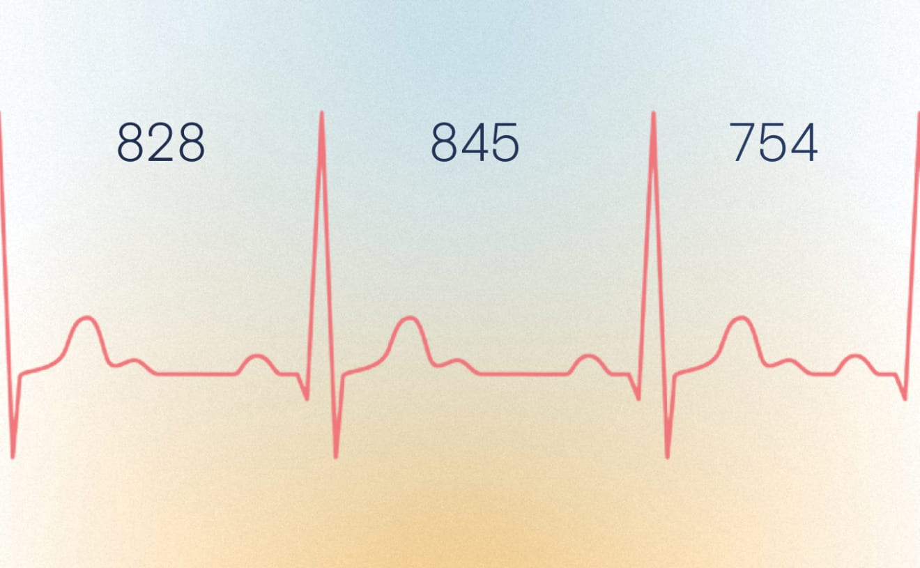 What is HRV and why does it matter? – Apollo Neuro